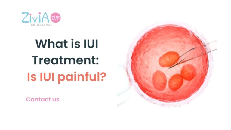 What is Intrauterine Insemination (IUI) Treatment: Is IUI painful?
